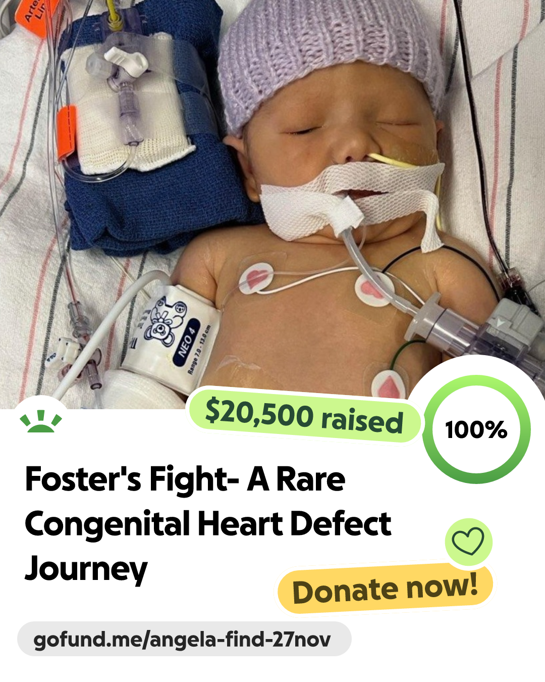 Fundraiser by Angela Bonnell : Foster's Fight- A Rare Congenital Heart ...
